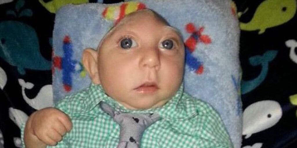 La Nación Jaxon El Bebe Que Sobrevive Con Medio Cerebro